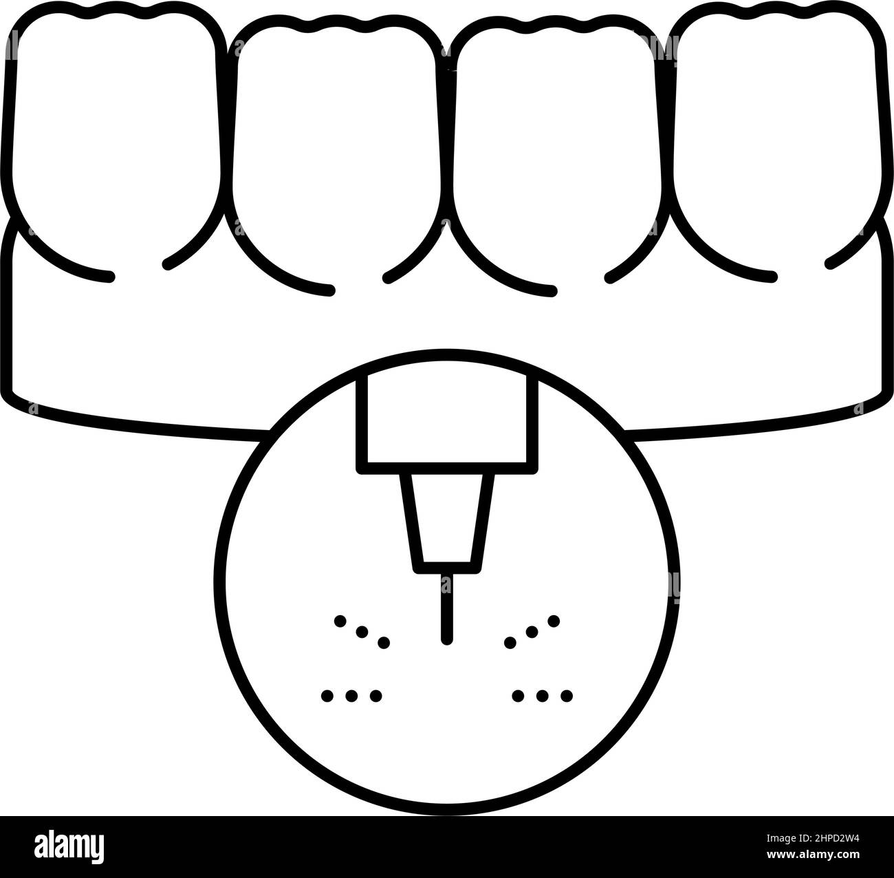 stomatology teeth laser treatment line icon vector illustration Stock ...