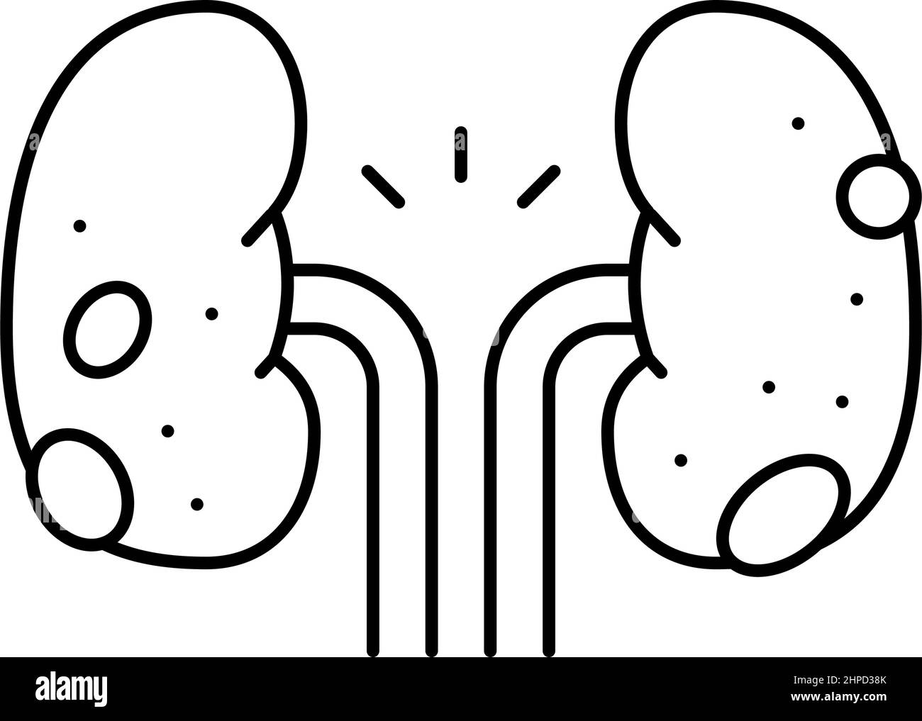 glomerulonephritis kidney disease line icon vector illustration Stock ...