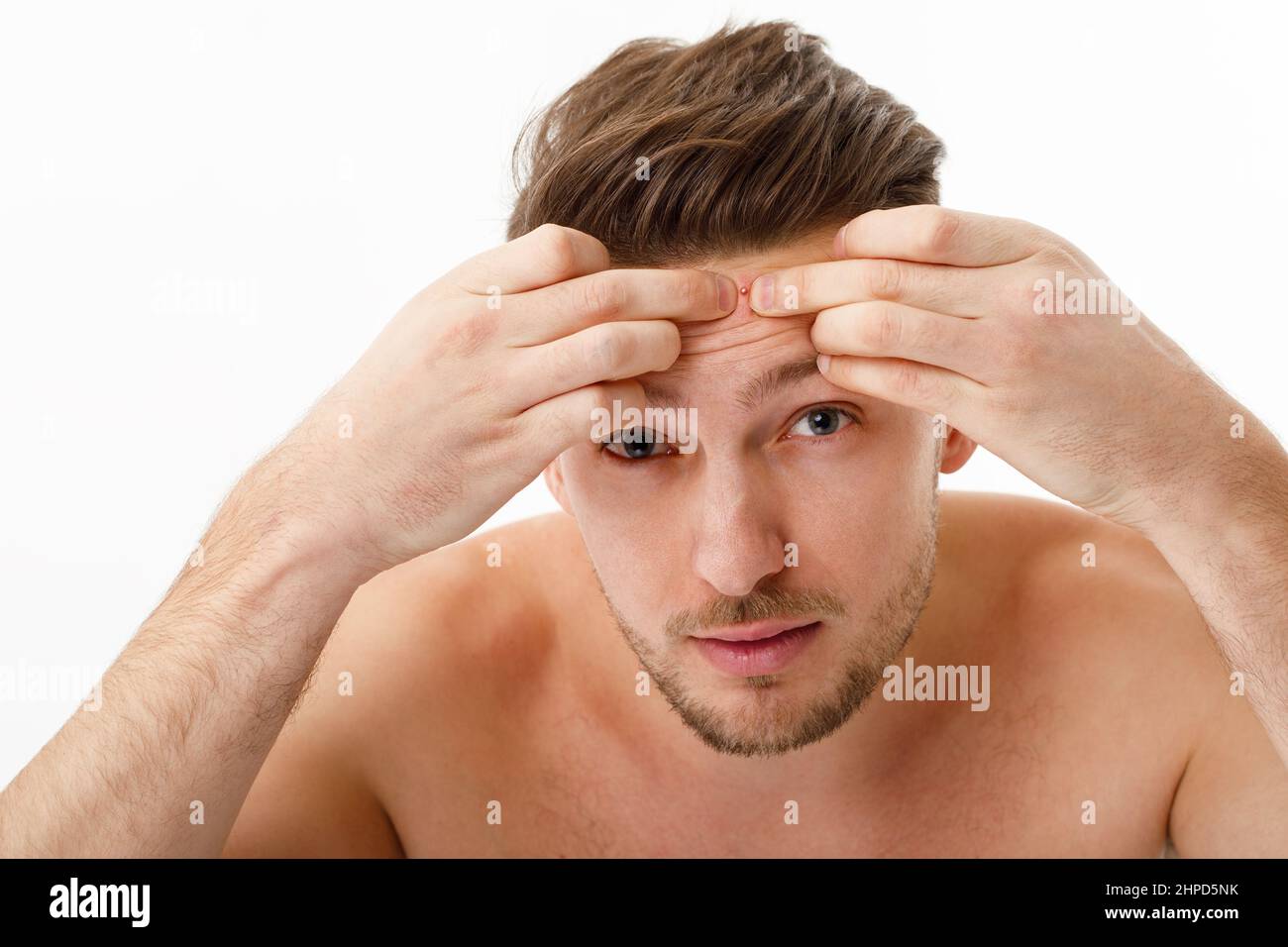 A young man squeezes out a pimple on his face while looking in the ...