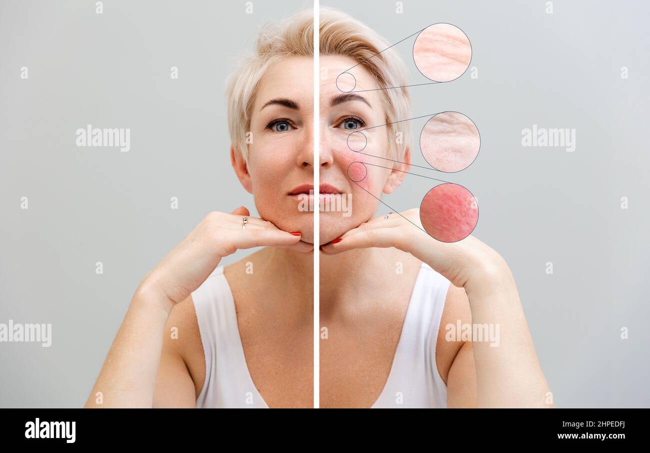 Professional cosmetology and plastic surgery. Portrait of a adult ...