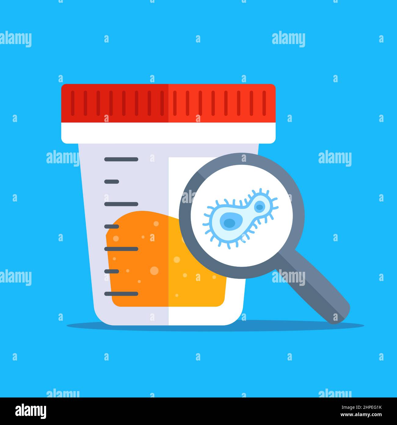 positive result in urine analysis. flat vector illustration Stock ...