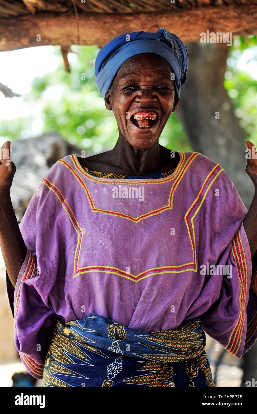 A Burkinabe woman showing her bad rotting teeth Stock Photo - Alamy