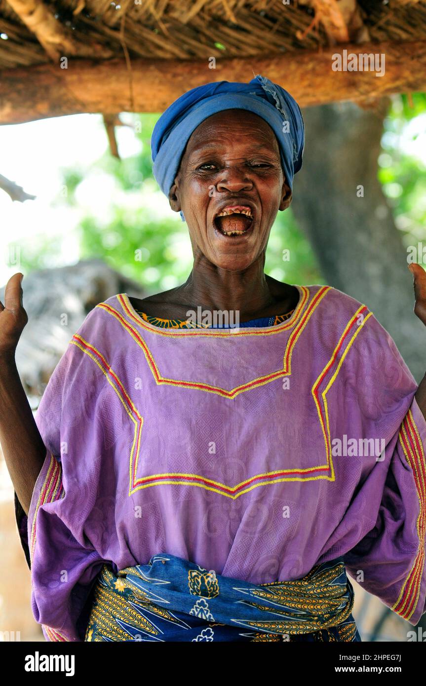 A Burkinabe woman showing her bad rotting teeth Stock Photo - Alamy