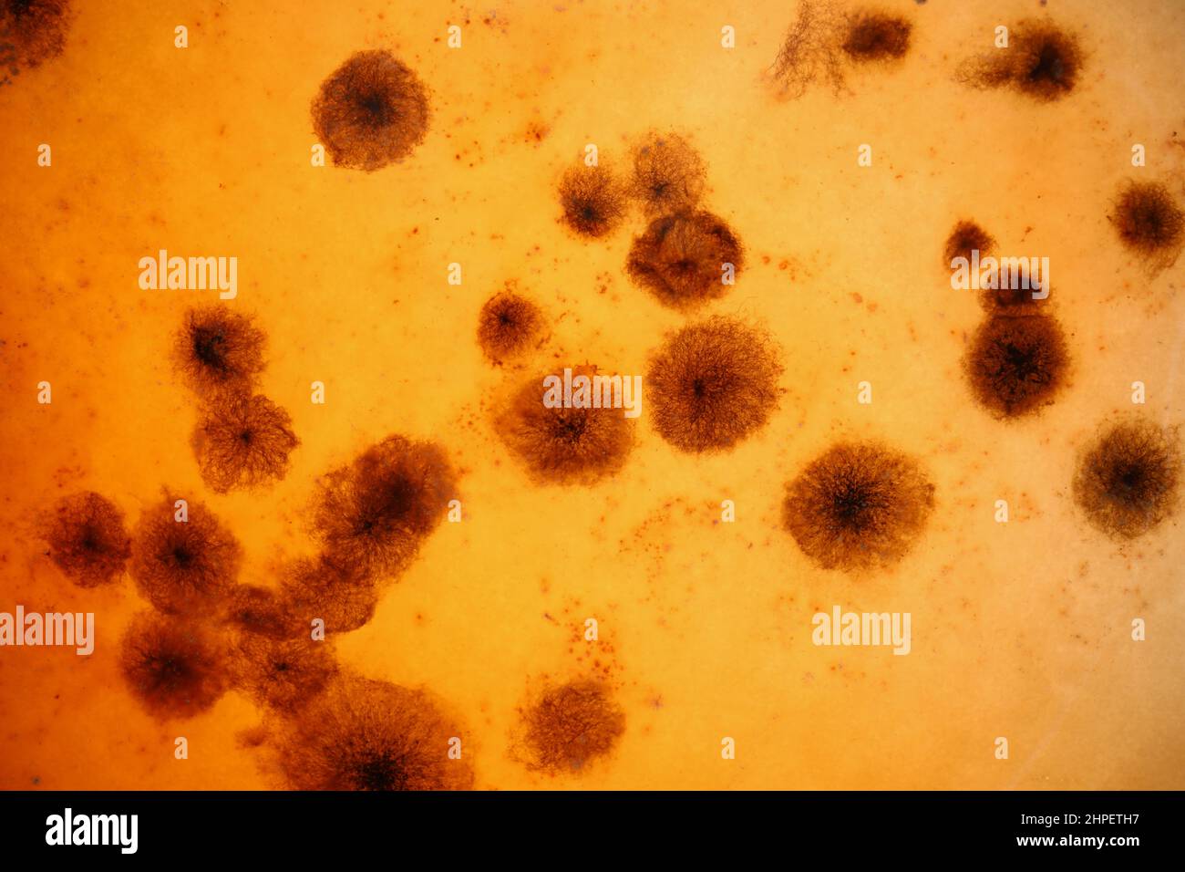Blood analysis with microbes under microscope, material professional ...