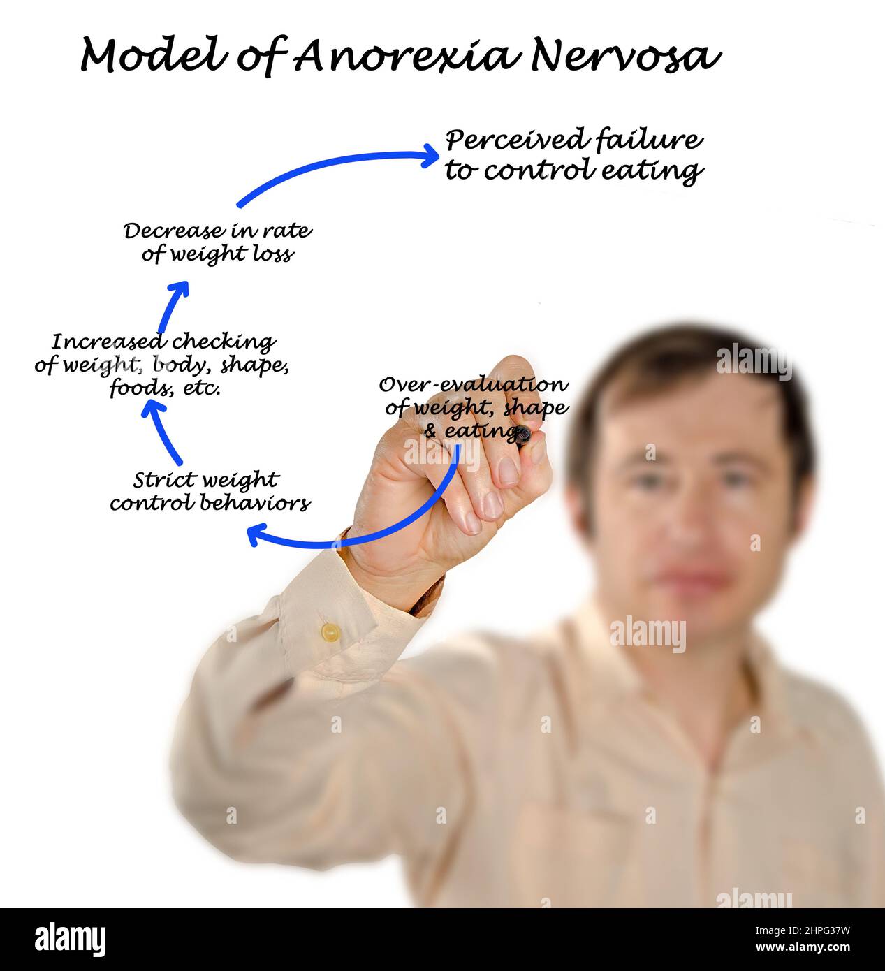 Model of Development of Anorexia Nervosa Stock Photo - Alamy