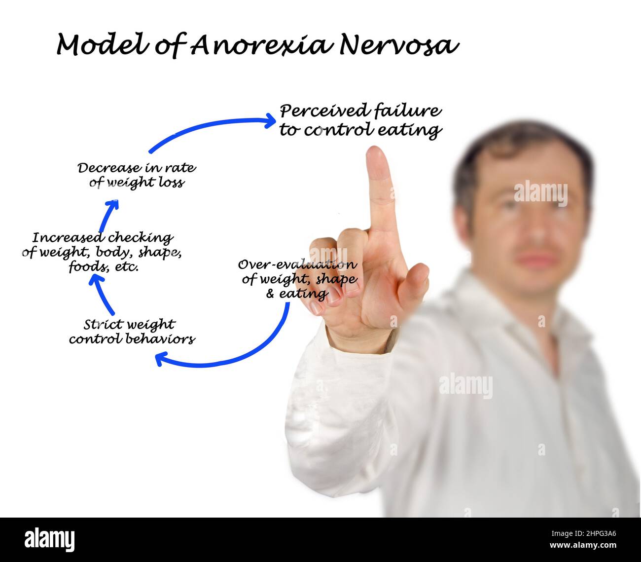 Model of Development of Anorexia Nervosa Stock Photo - Alamy
