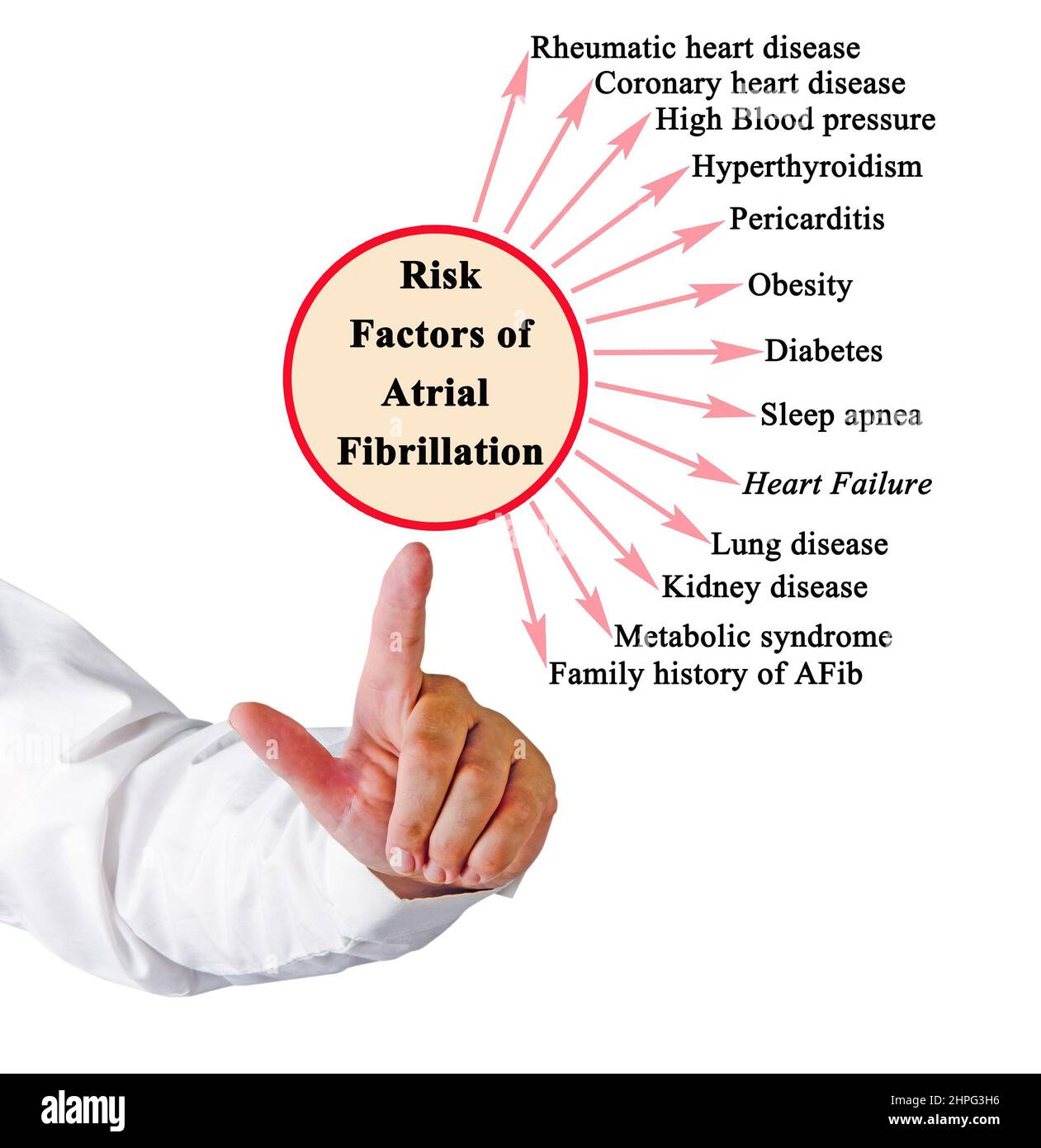 Risk factors of atrial fibrilation Stock Photo - Alamy