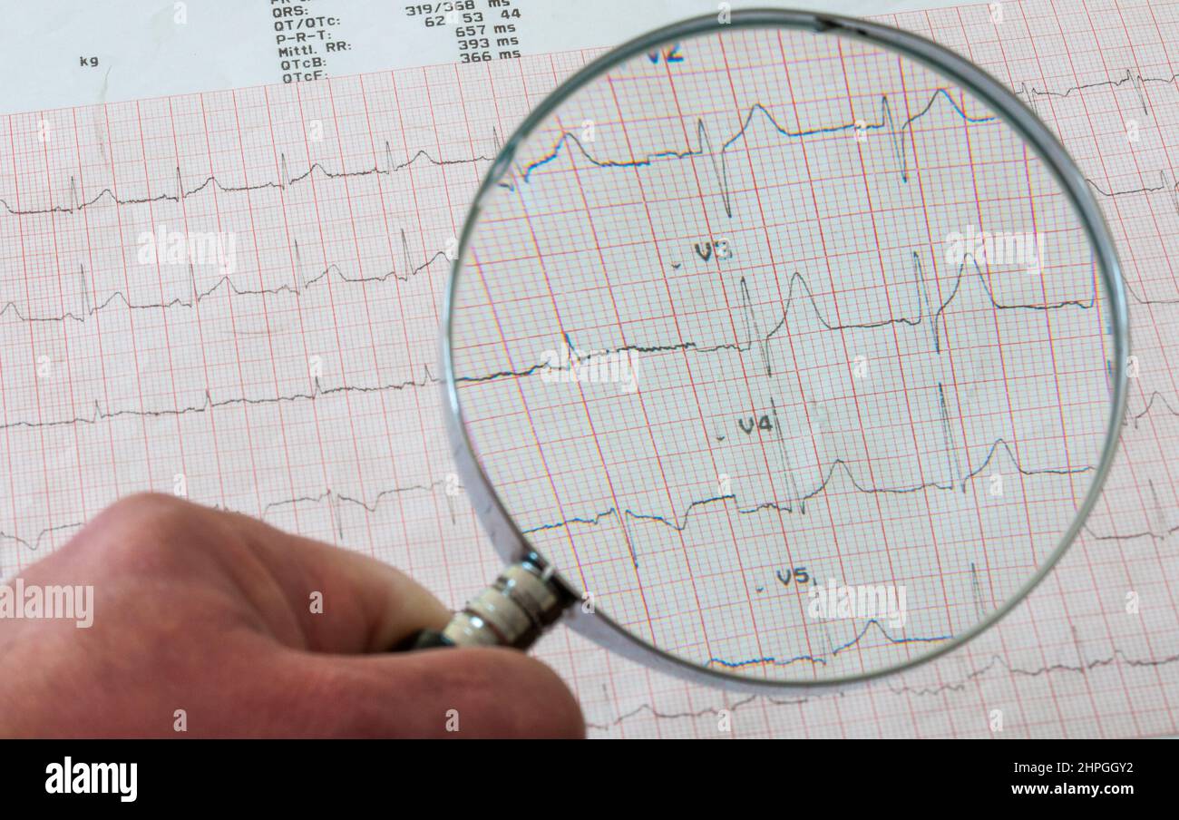 Hand holding magnifying glass and chart electrocardiogram (ECG) of ...