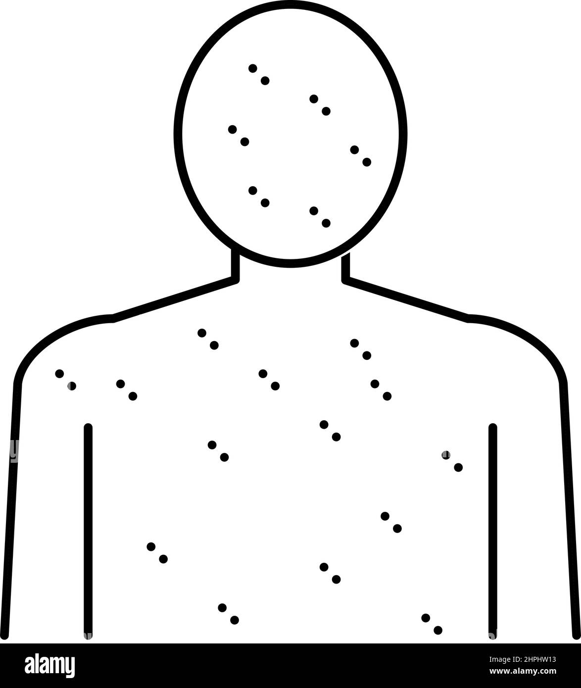 rash full body color icon vector illustration Stock Vector Image & Art ...