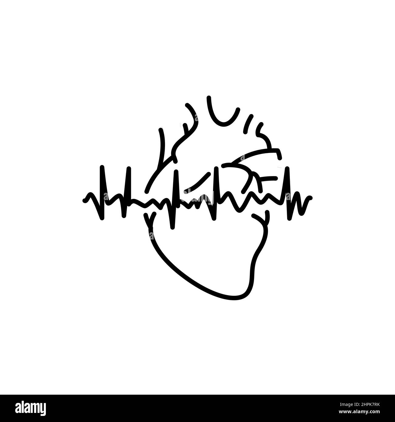 Irregular heartbeat color line icon. Human diseases. Pictogram for web ...