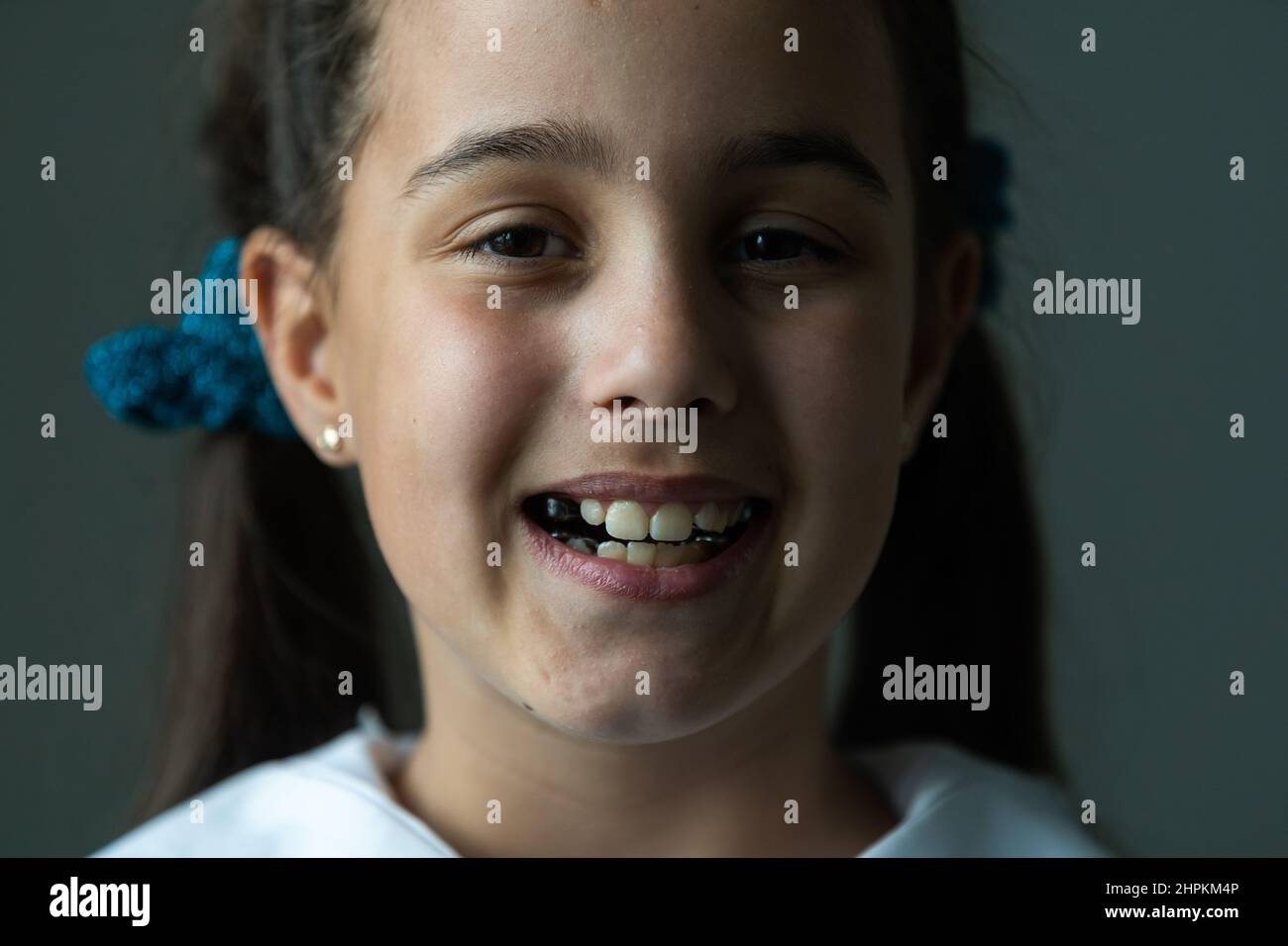 little girl with a plate on her teeth Stock Photo - Alamy