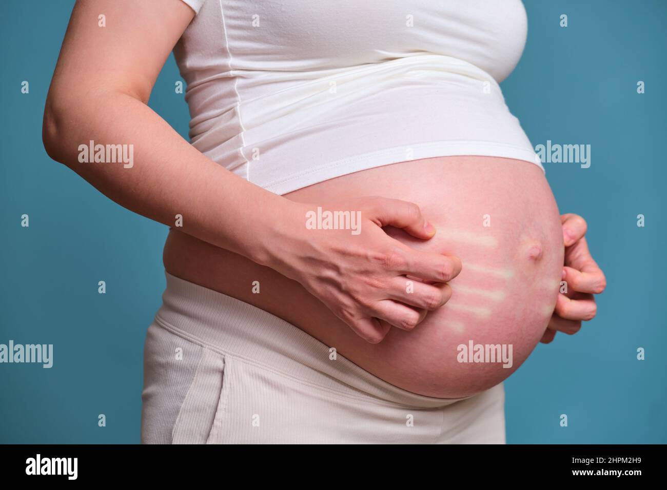 Hands of a pregnant woman scratching her stomach, blue background Stock ...