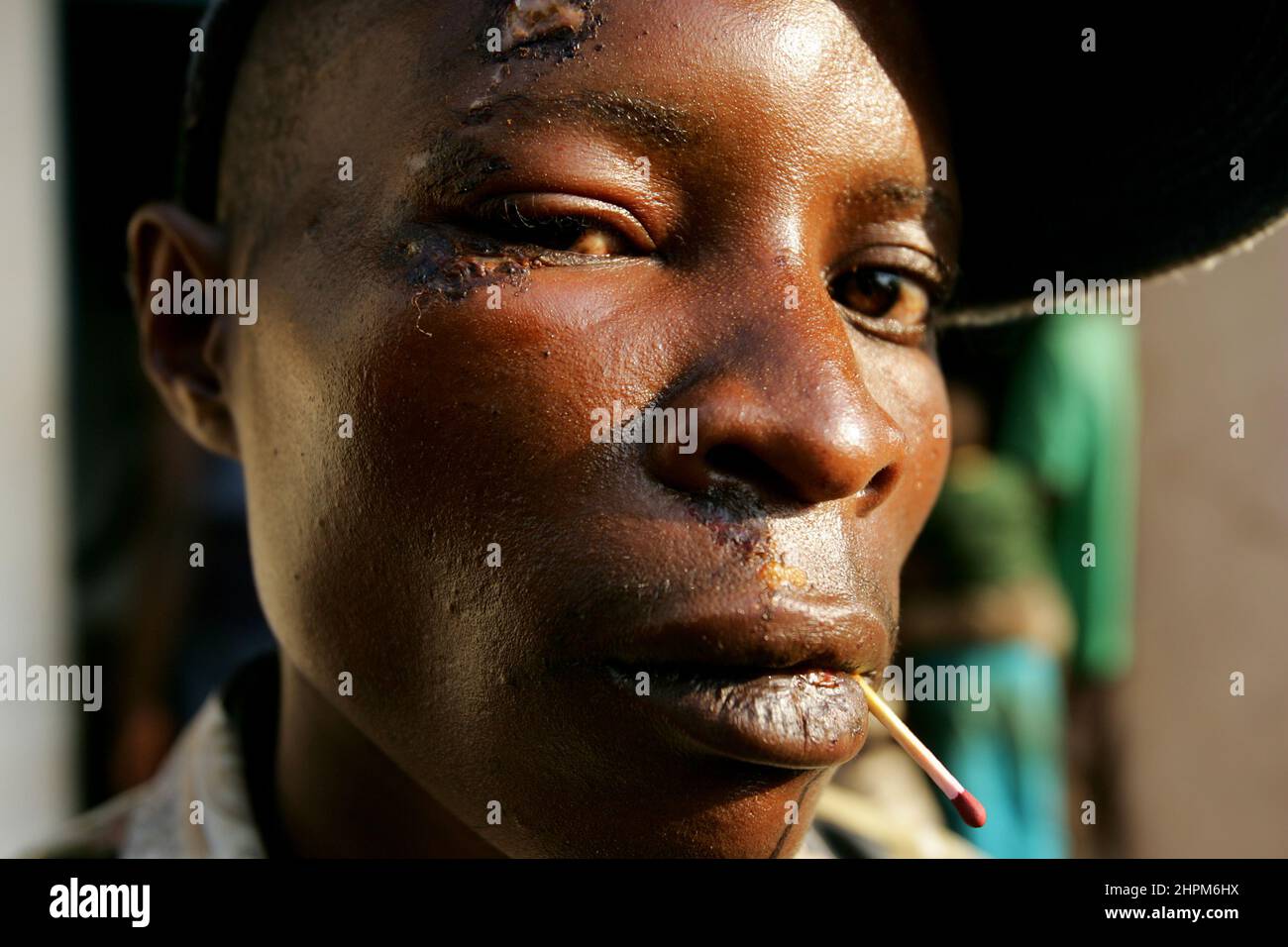 Poverty in slums hi-res stock photography and images - Alamy