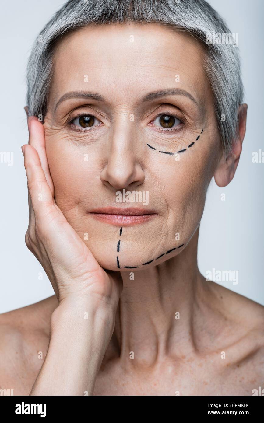 Woman plastic surgery face lines hi-res stock photography and images ...