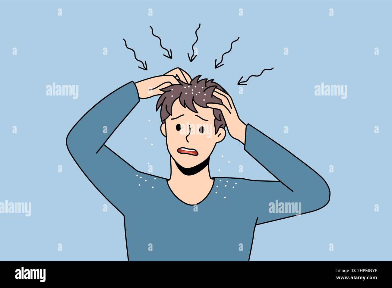 Itchy head and dandruff concept. Stressed irritated man standing and ...