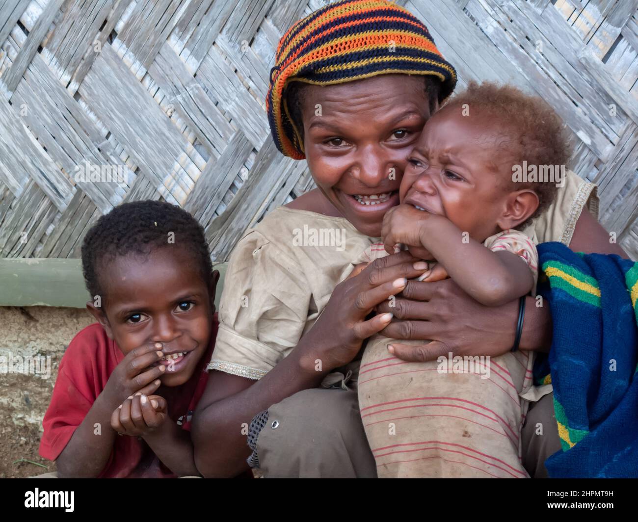 Albinism eyes hi-res stock photography and images - Alamy