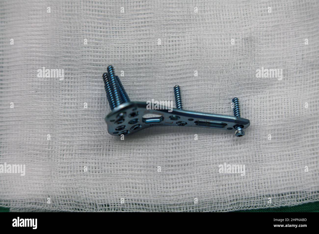 Titanium plate implant on human hi-res stock photography and images - Alamy
