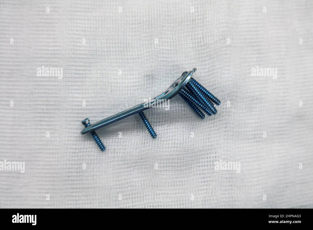 Titanium plate implant on human hi-res stock photography and images - Alamy