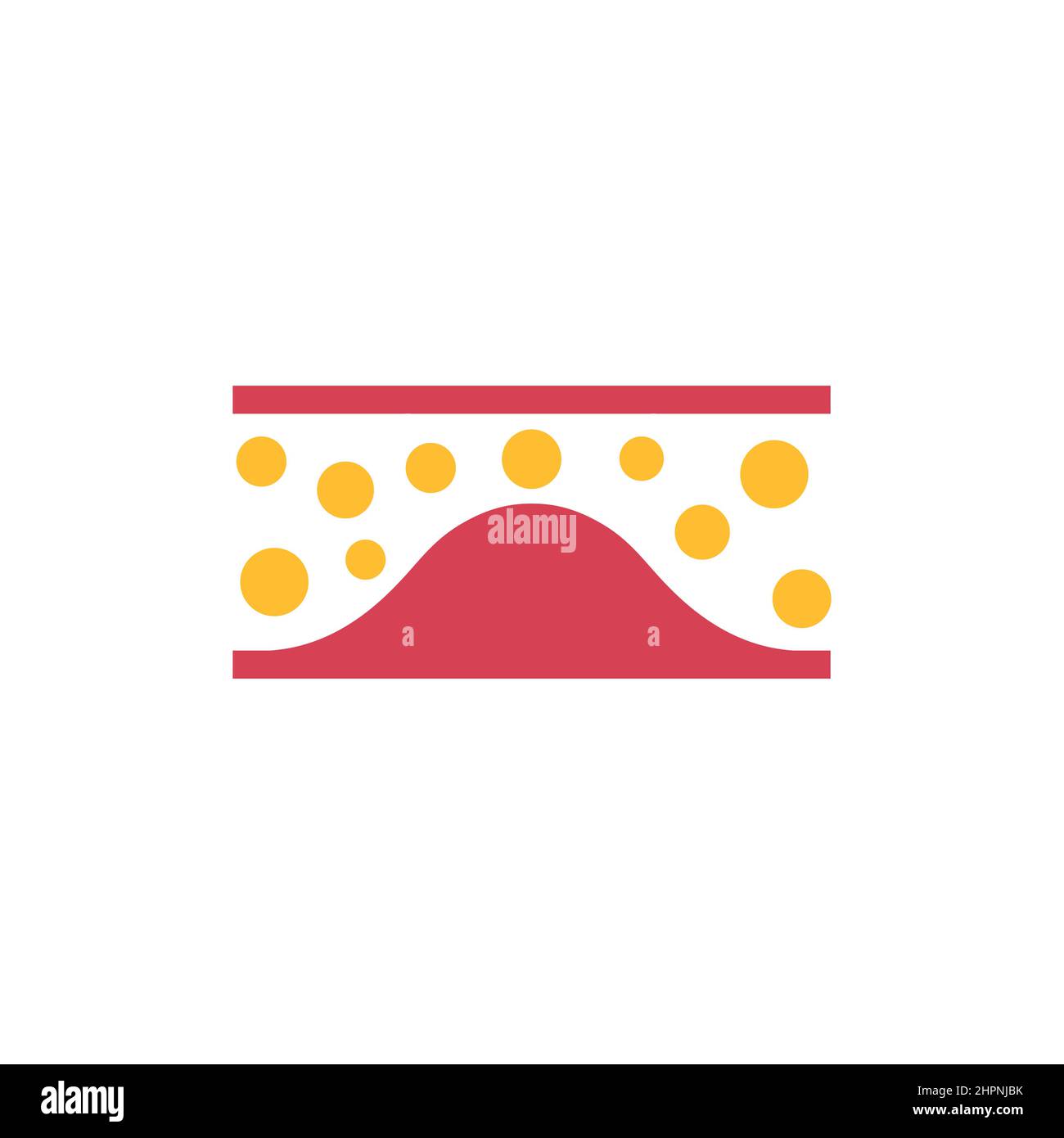 Cholesterol icon artery thrombosis micro vascular desease ...