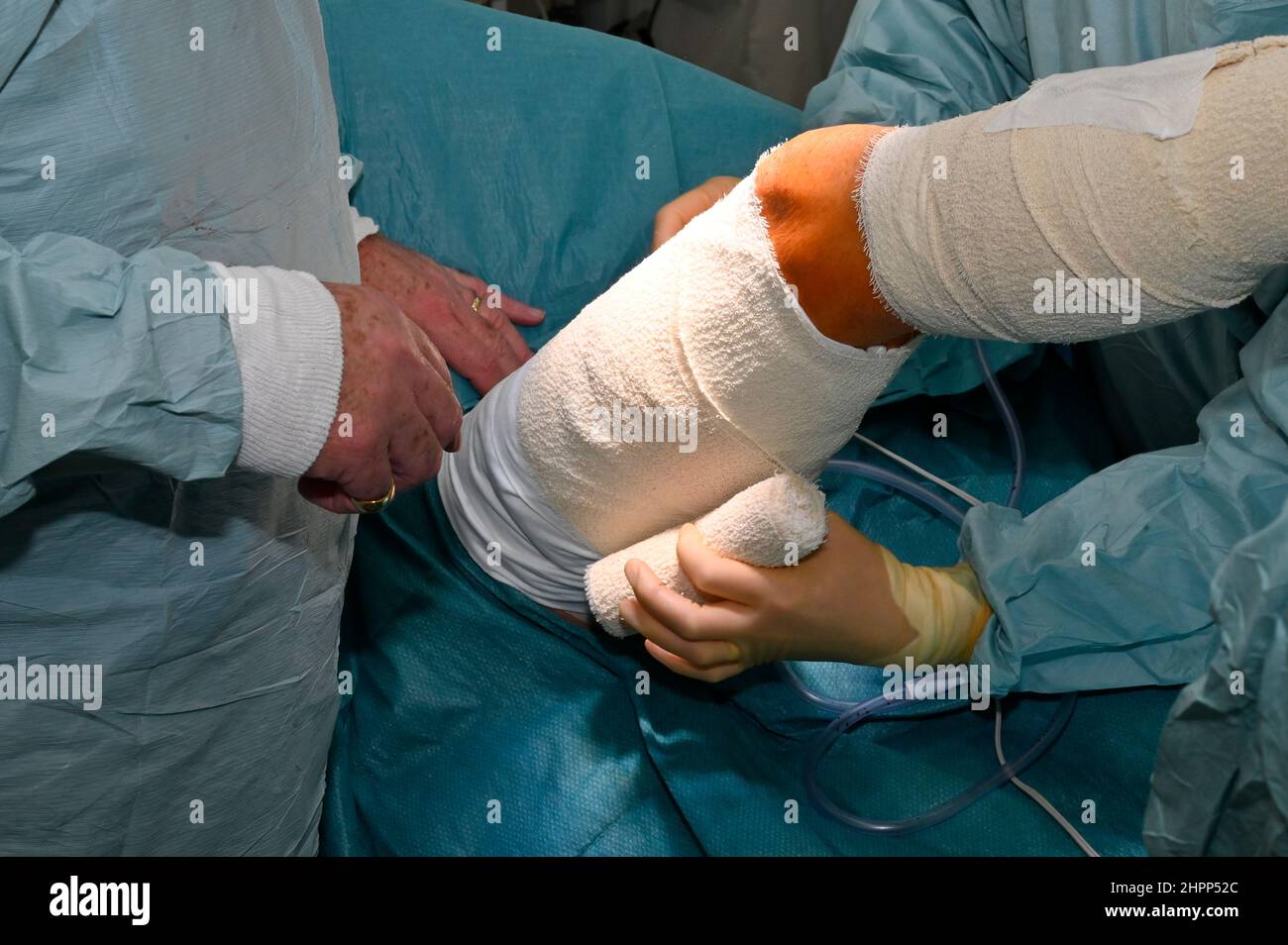 Bandaging of patient's leg after excision of skin cancer Stock Photo ...