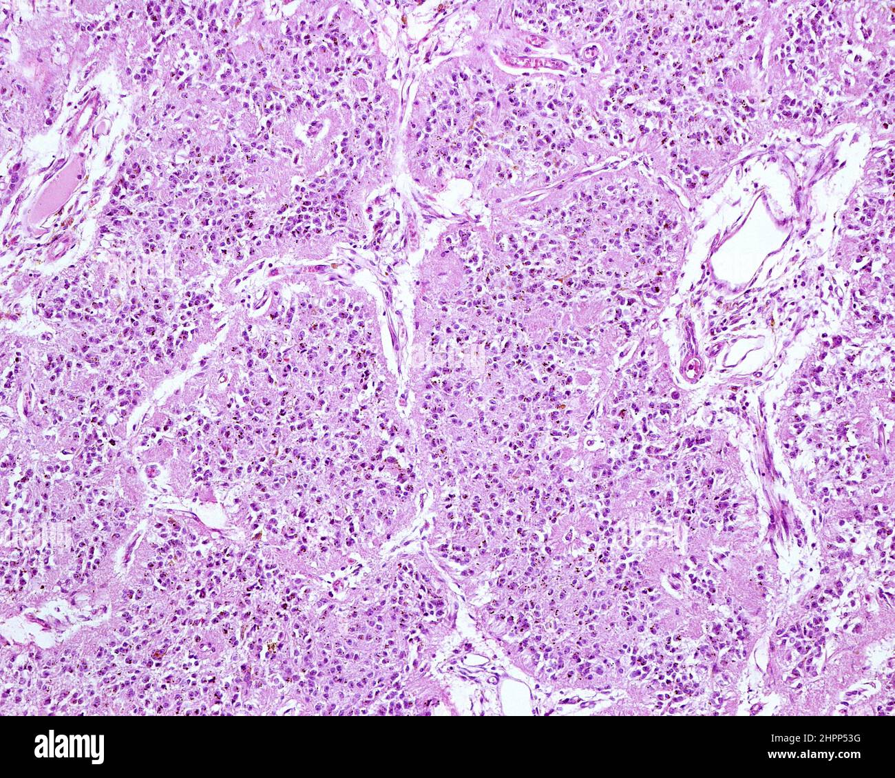 Human pineal gland lobulation, light micrograph Stock Photo - Alamy