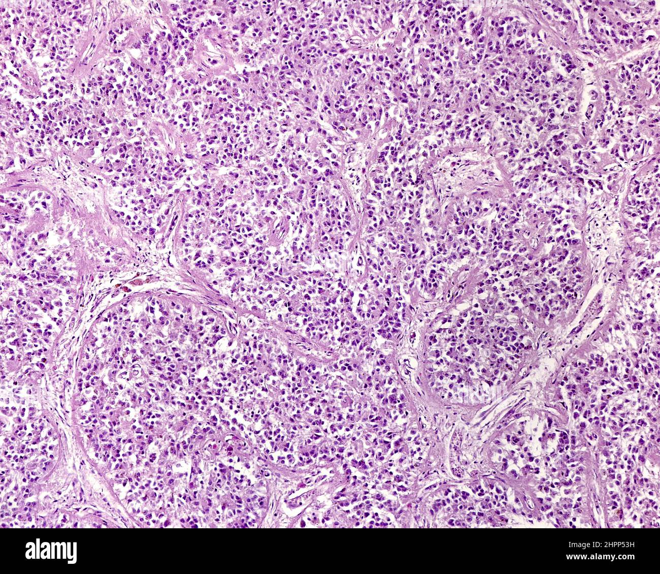 Human pineal gland lobulation, light micrograph Stock Photo - Alamy