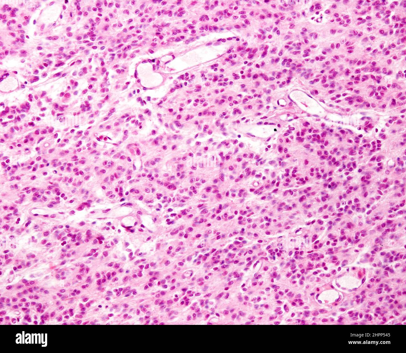 Human pineal gland lobulation, light micrograph Stock Photo - Alamy