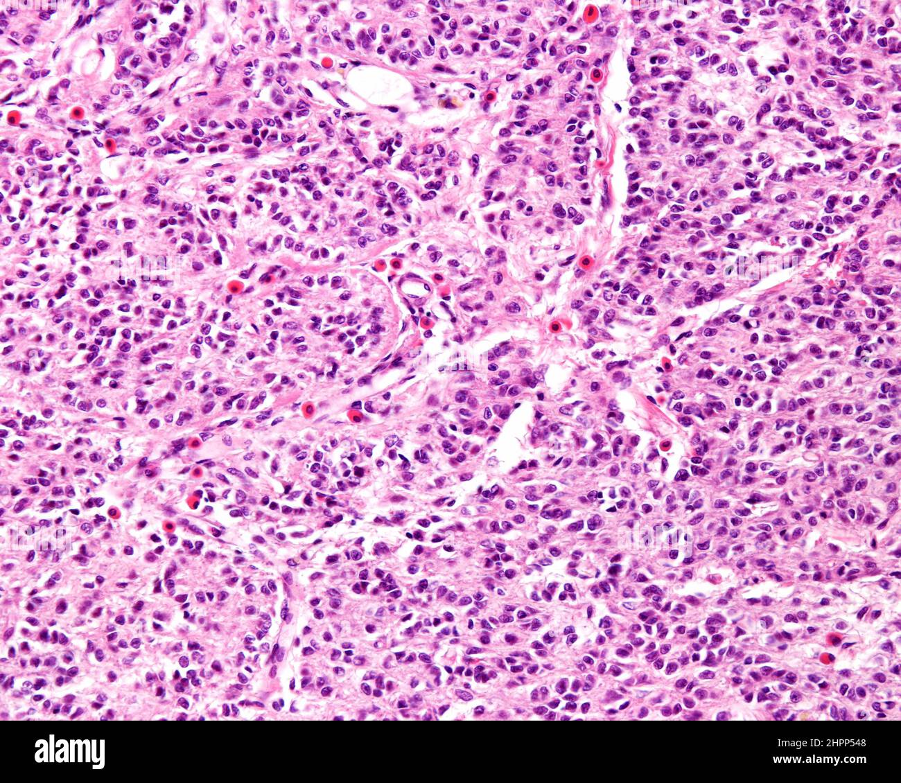 Mast cells in human pineal gland, light micrograph Stock Photo - Alamy