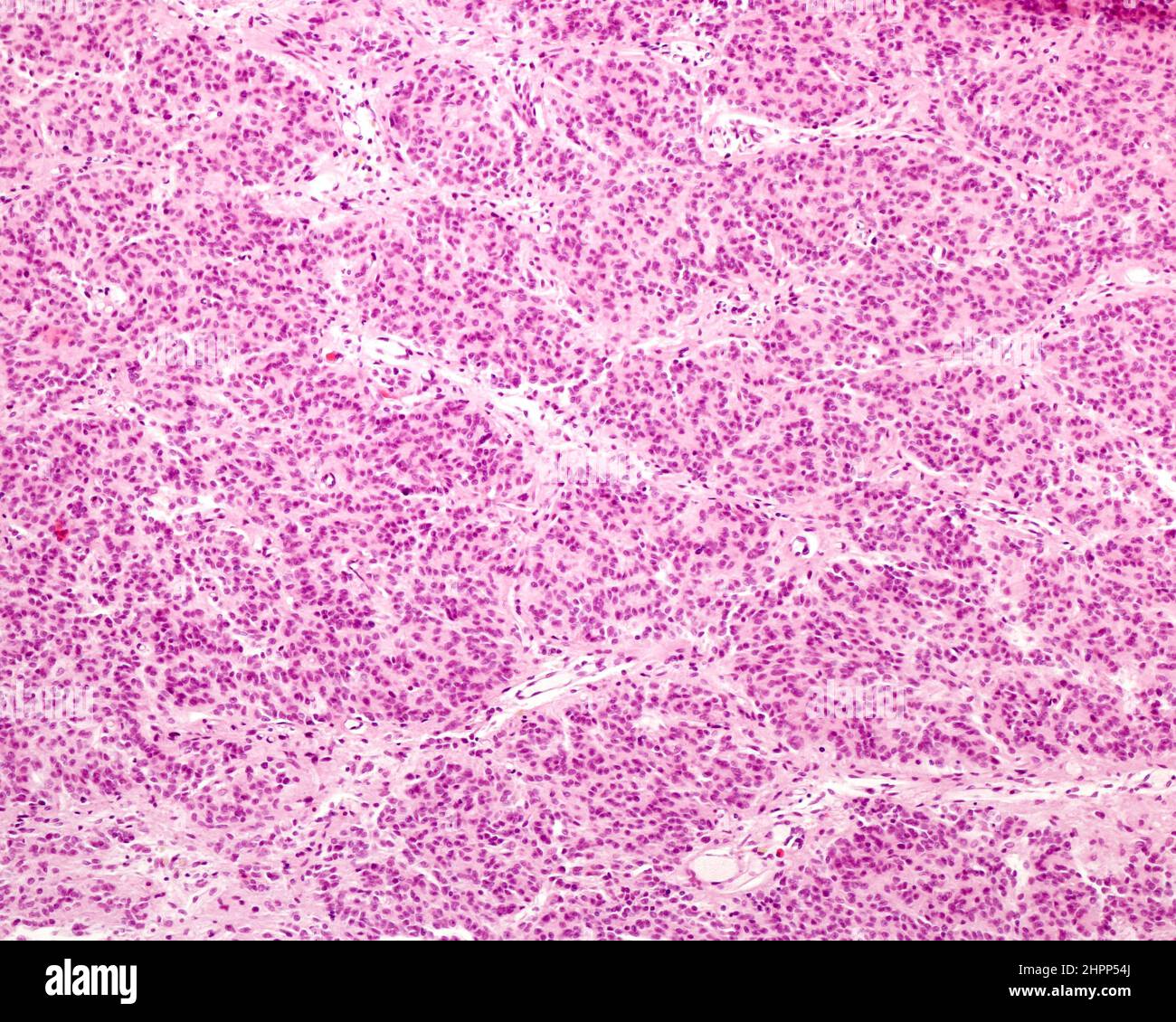 Human pineal gland lobulation, light micrograph Stock Photo - Alamy