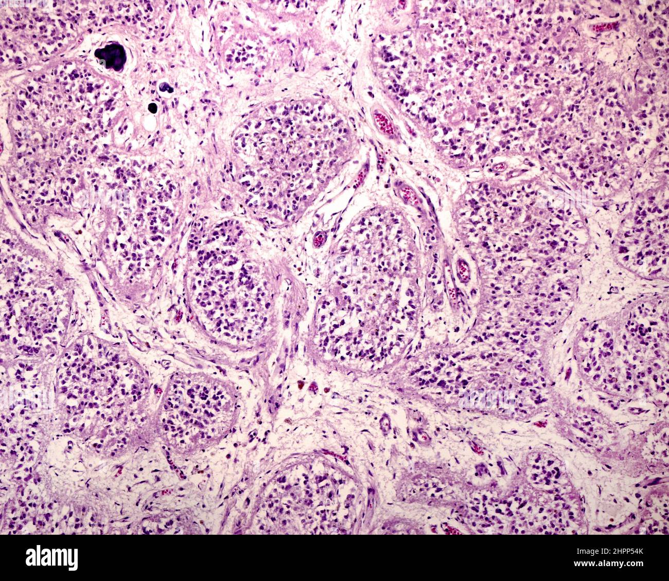 Pineal gland lobulation, light micrograph Stock Photo - Alamy