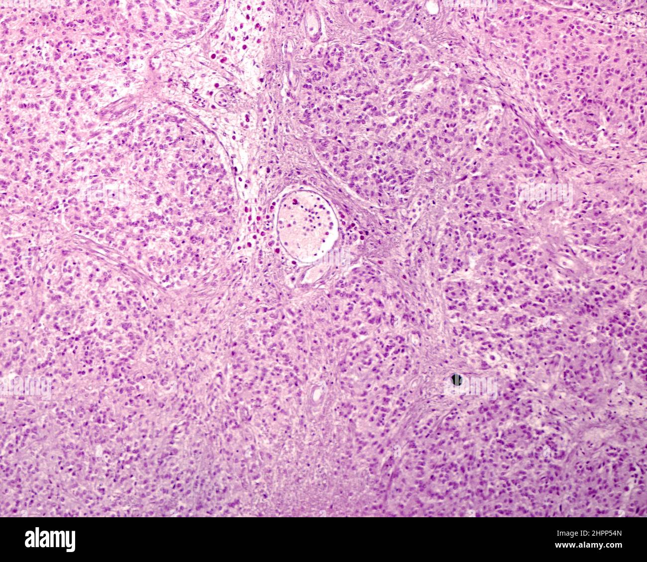 Human pineal gland lobulation, light micrograph Stock Photo - Alamy