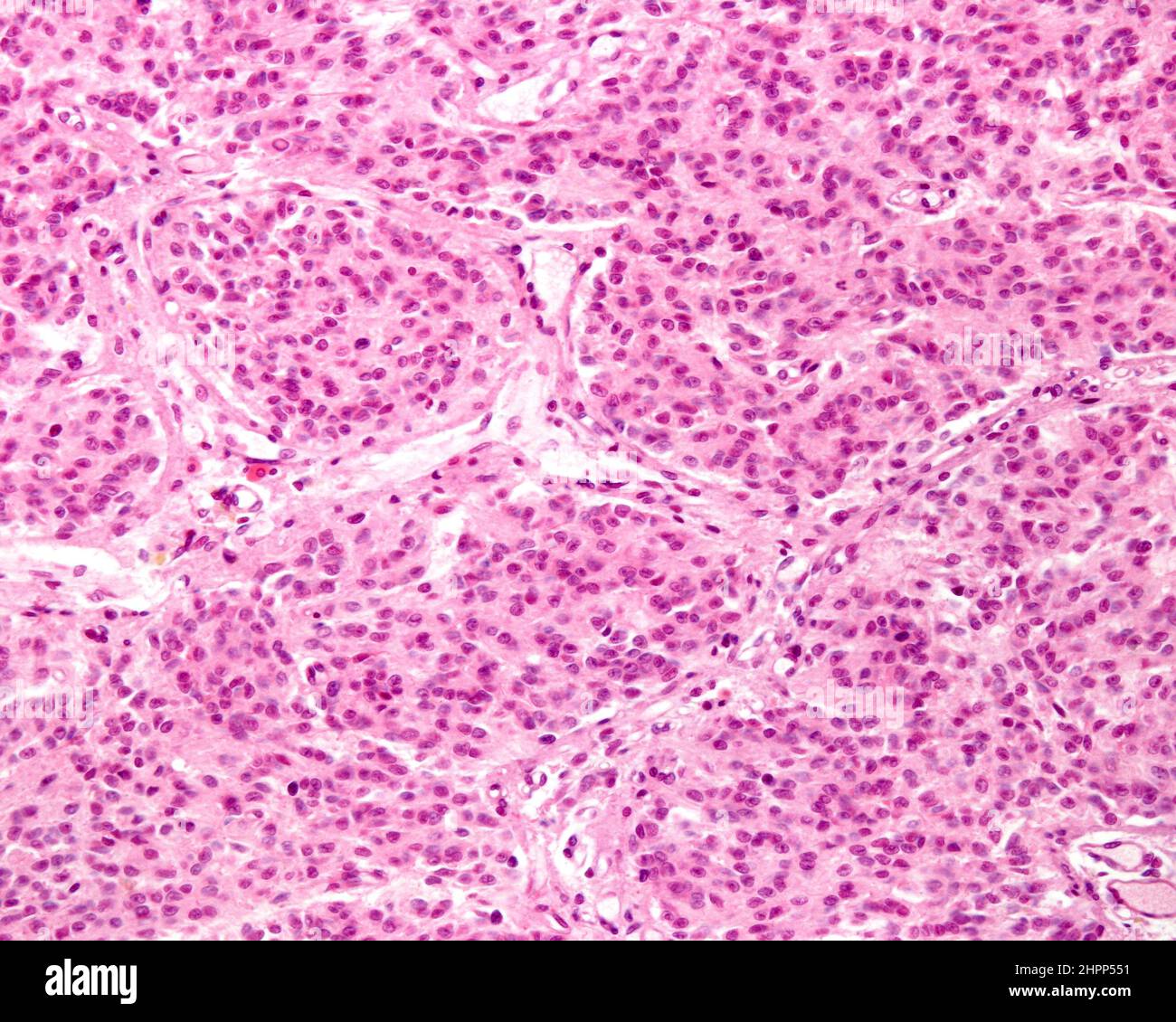 Human pineal gland lobulation, light micrograph Stock Photo - Alamy