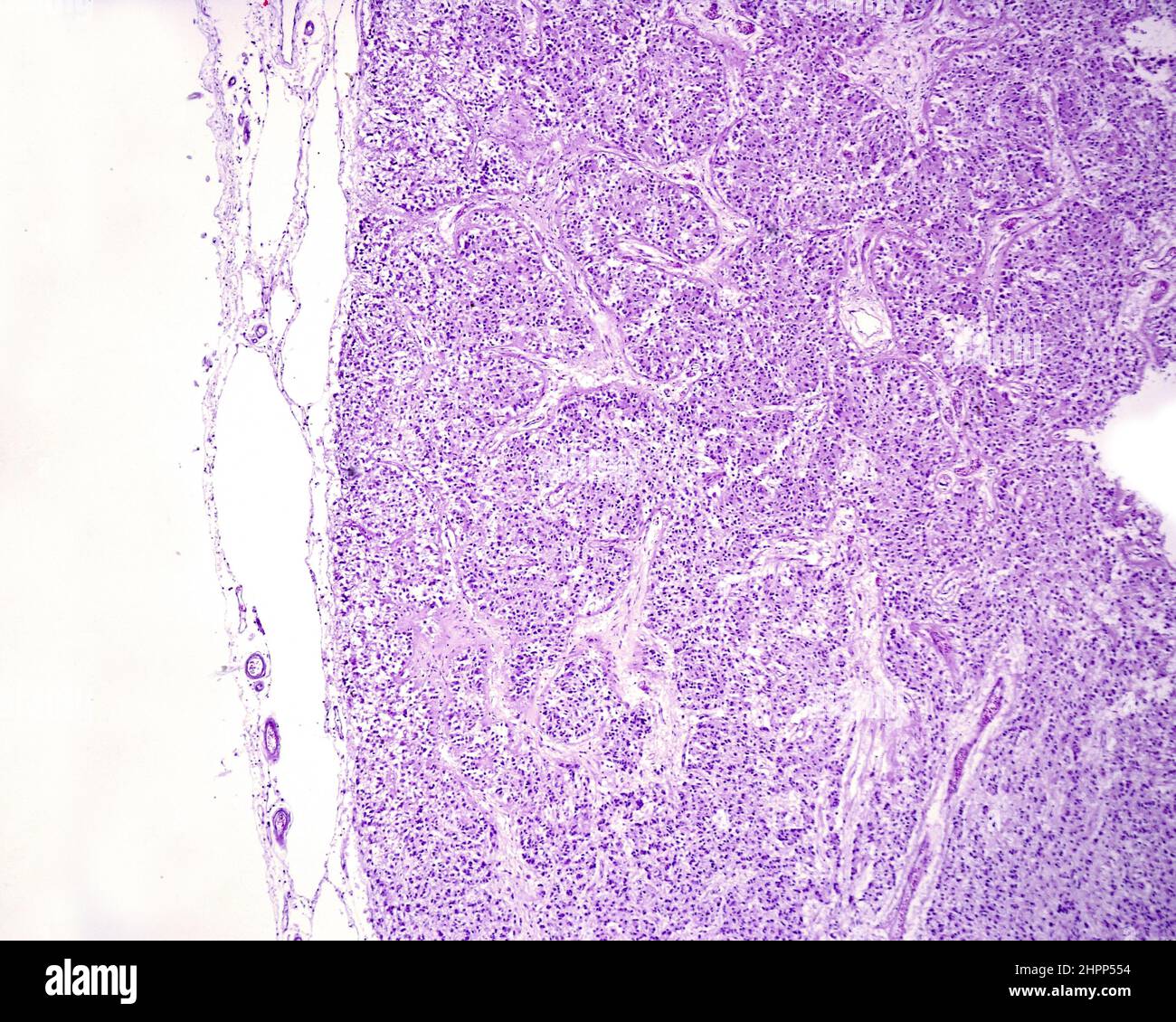 Human pineal gland lobulation, light micrograph Stock Photo - Alamy