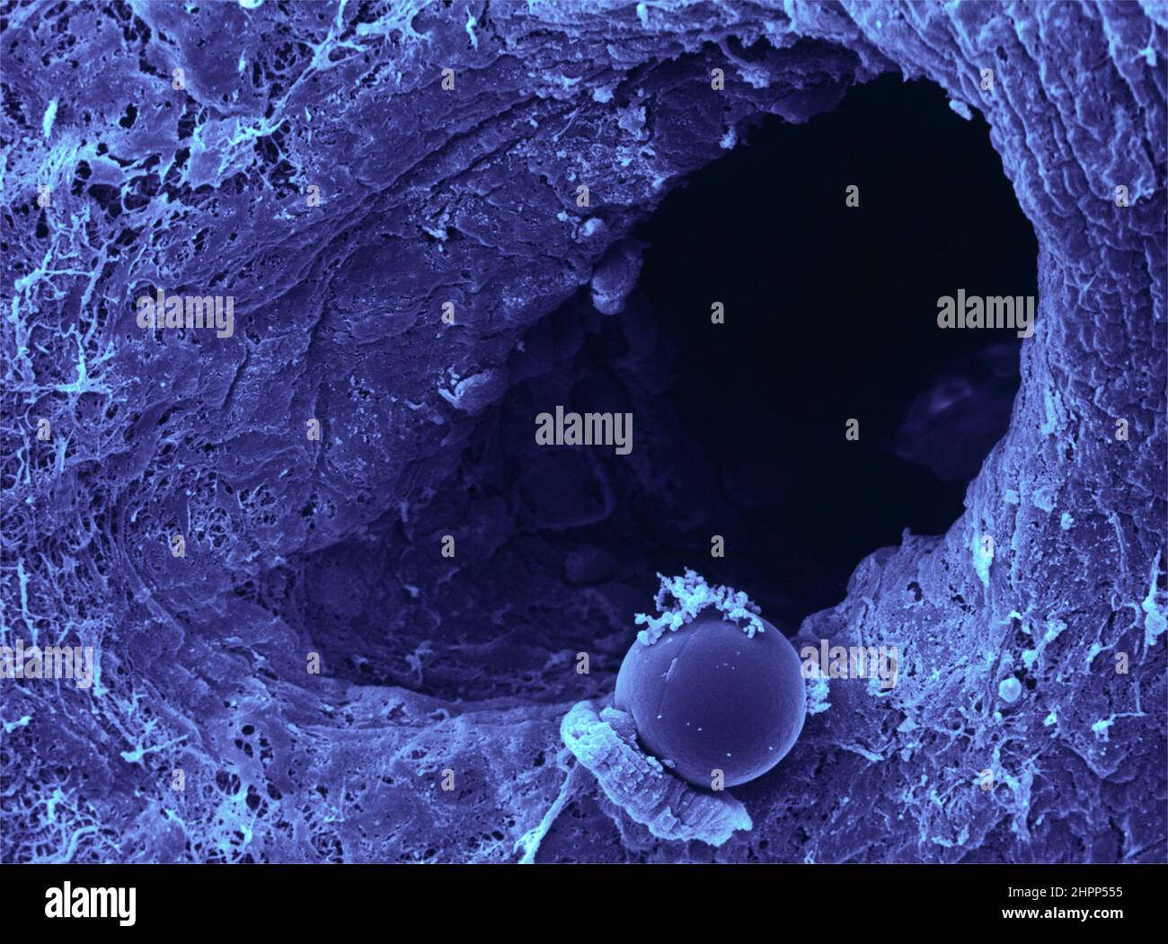 Coronary capillary, SEM Stock Photo - Alamy