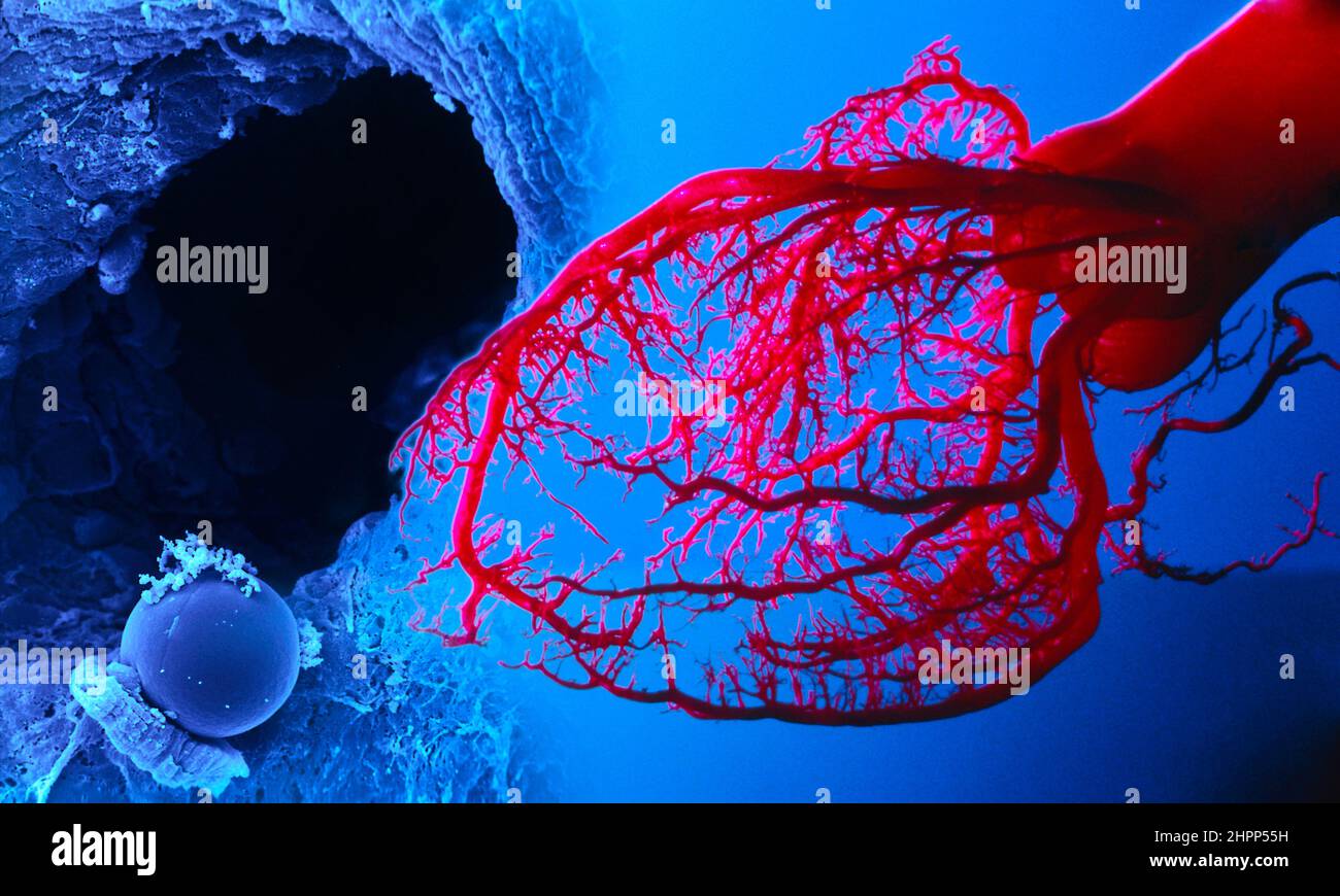 Coronary blood vessels, composite image Stock Photo - Alamy