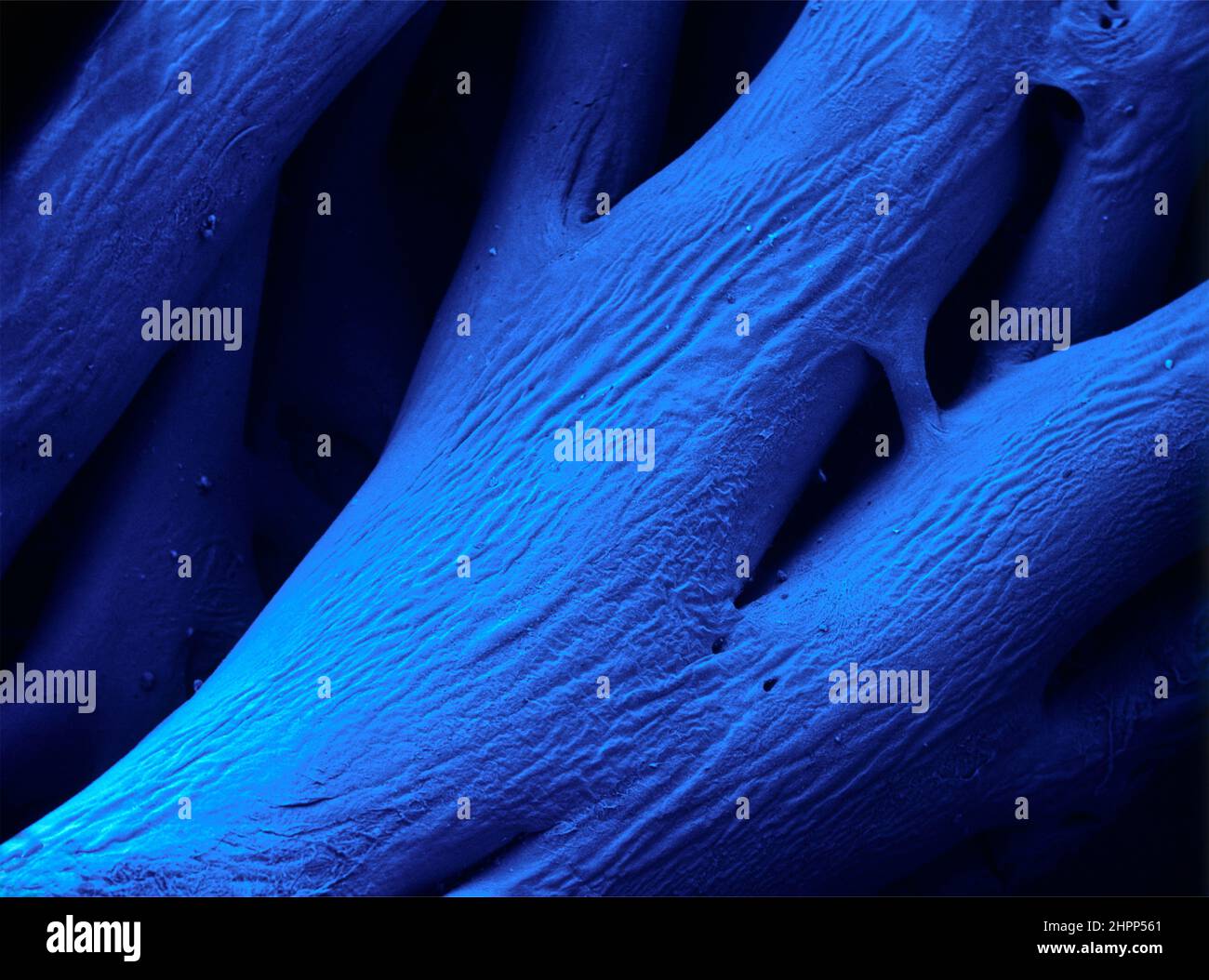 Papillary muscles and trabecular structure, SEM Stock Photo - Alamy