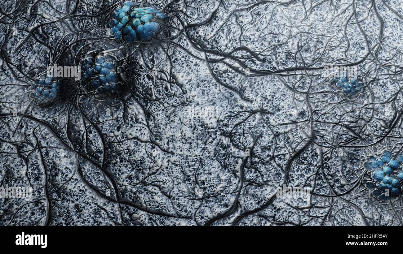 3d illustration of a cancer cell Stock Photo - Alamy