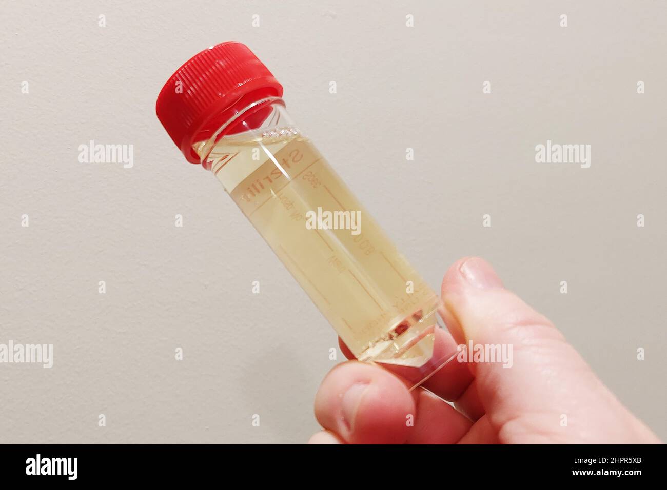 Medical Sample Test Tube Picture by Antony Thompson - Thousand Word ...