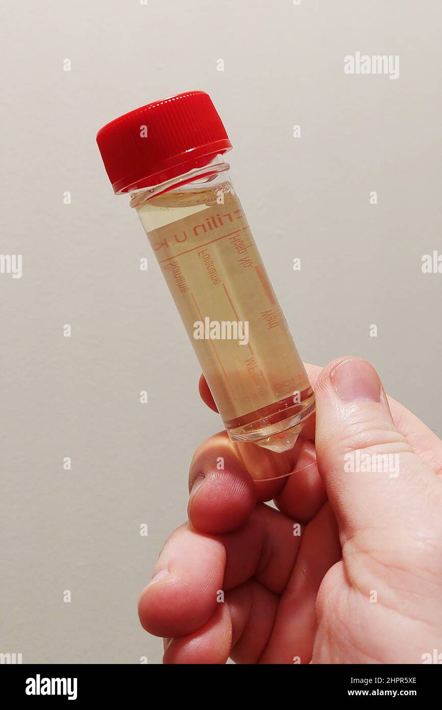 Medical Sample Test Tube Picture by Antony Thompson - Thousand Word ...