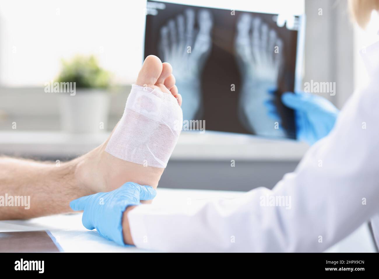 A doctor looks at an x-ray of a man's injured leg, blurry Stock Photo ...