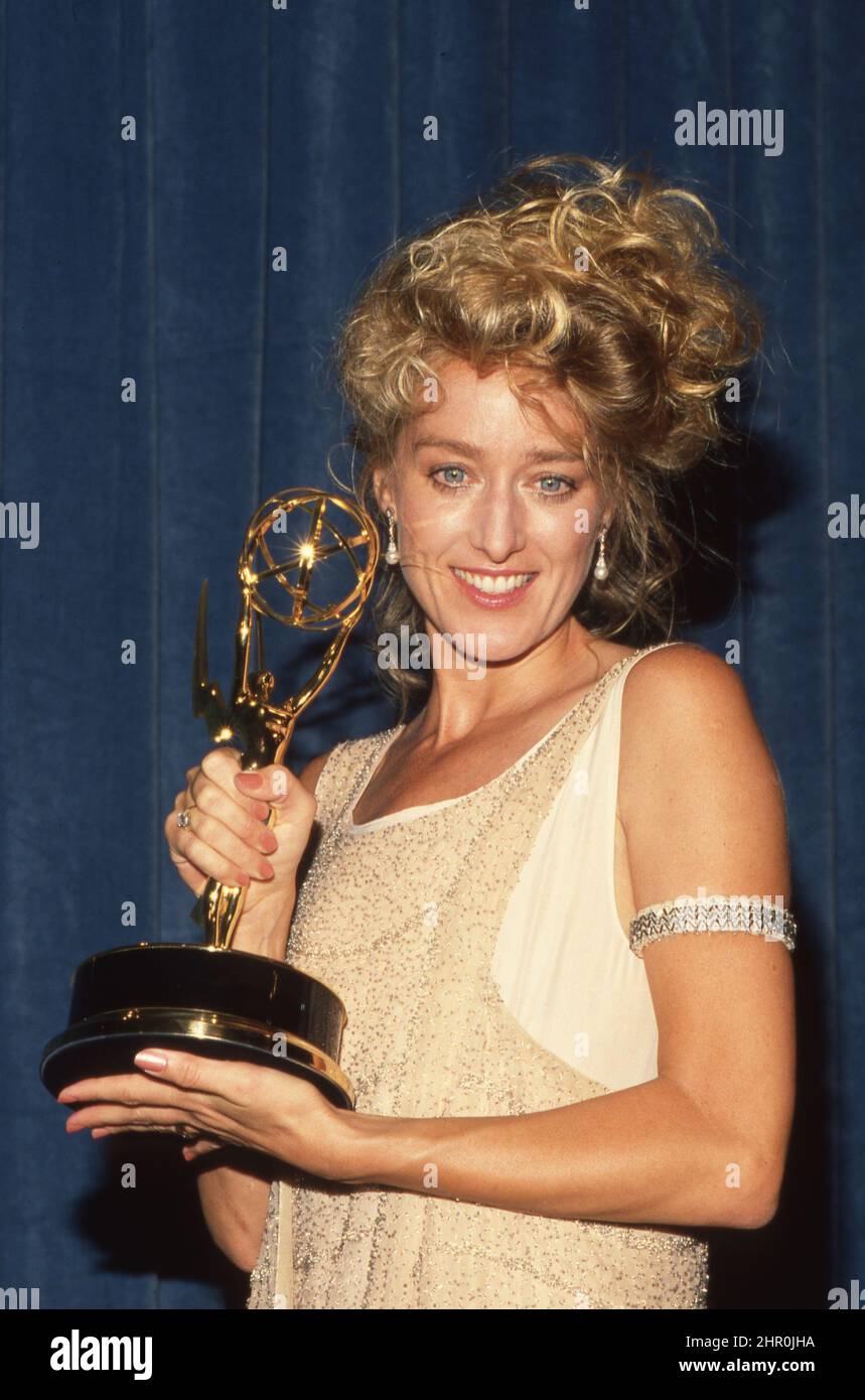 Patricia Wettig Plastic Surgery