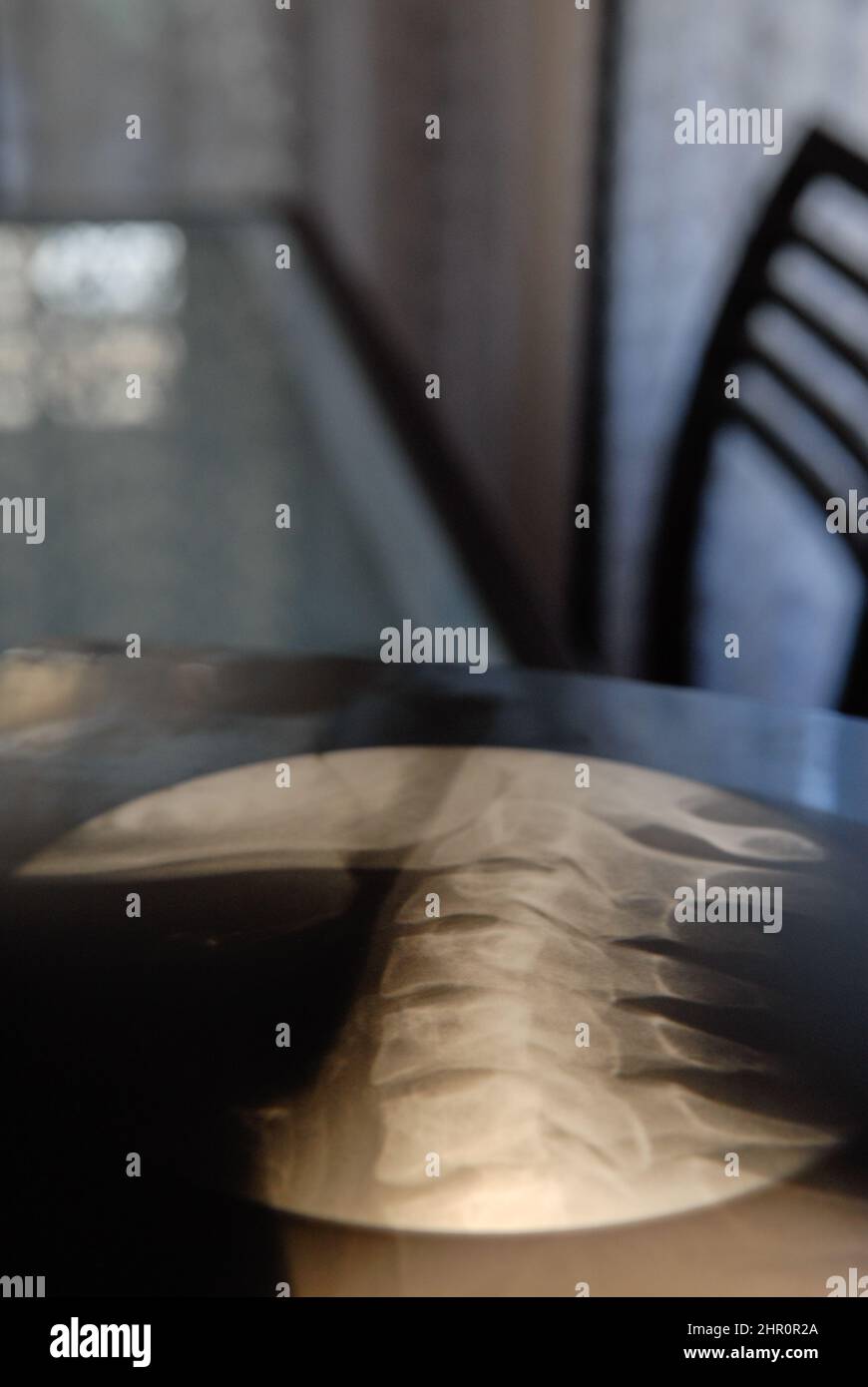 Male neck x-ray radiography on doctor table Stock Photo - Alamy