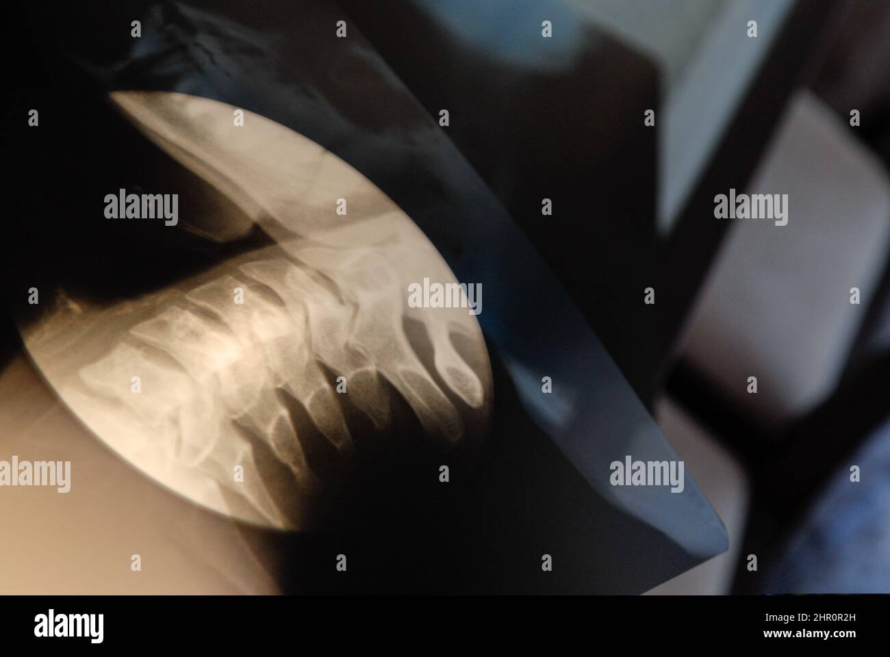 Male neck x-ray radiography on doctor table Stock Photo - Alamy