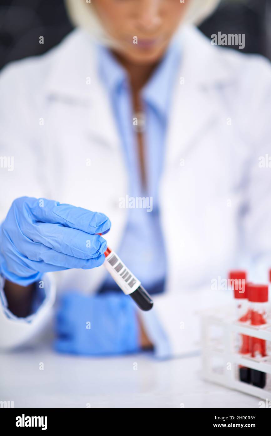 Pathology at work. Cropped shot of a scientist working with blood ...