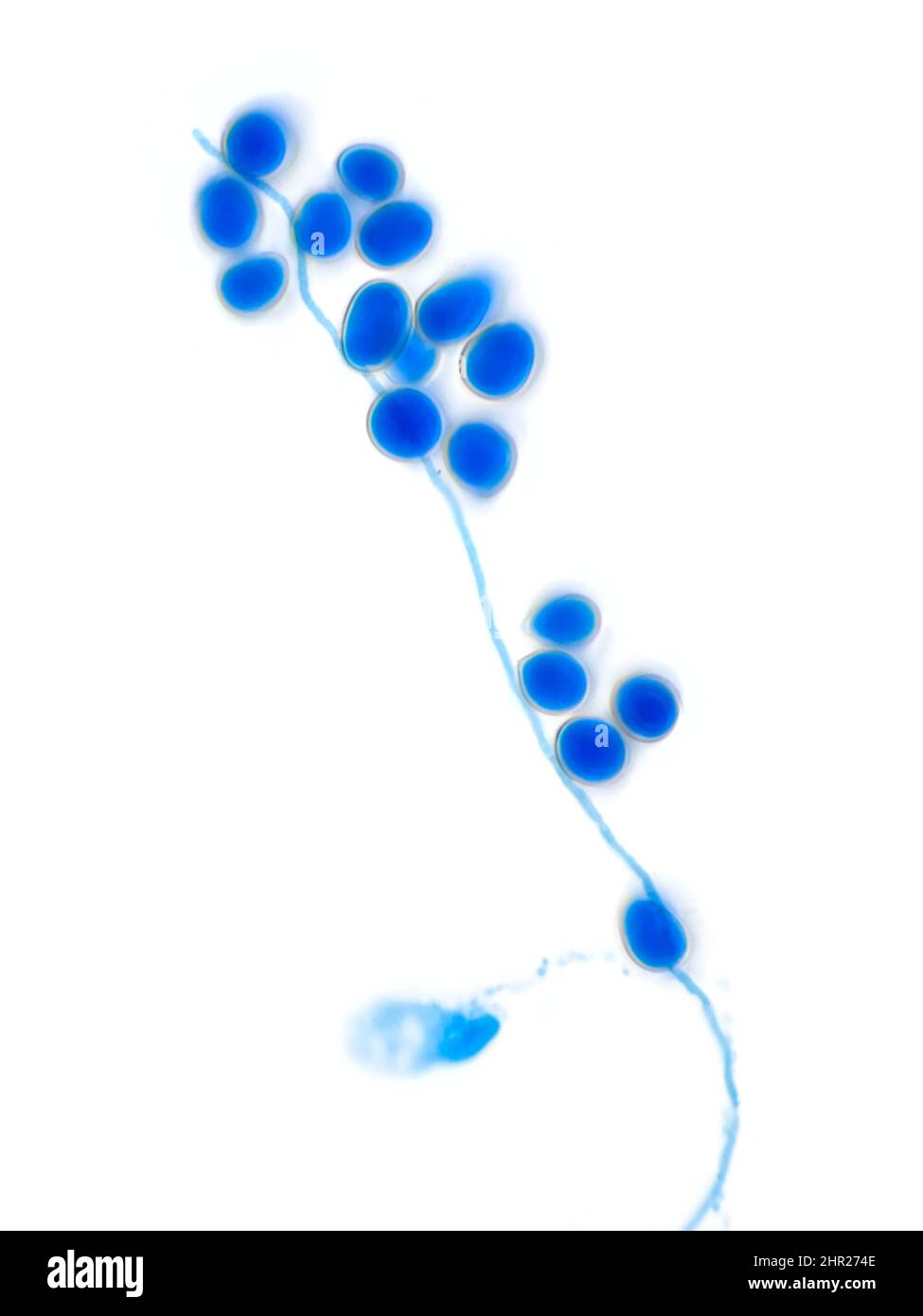 Penicillium Under Microscope 100x
