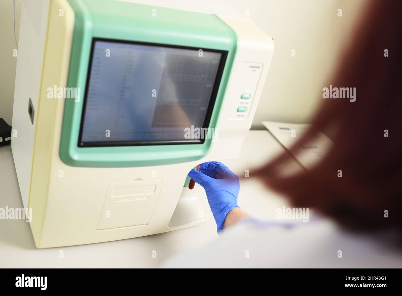 a laboratory assistant examines a blood sample in an analyzer in a ...