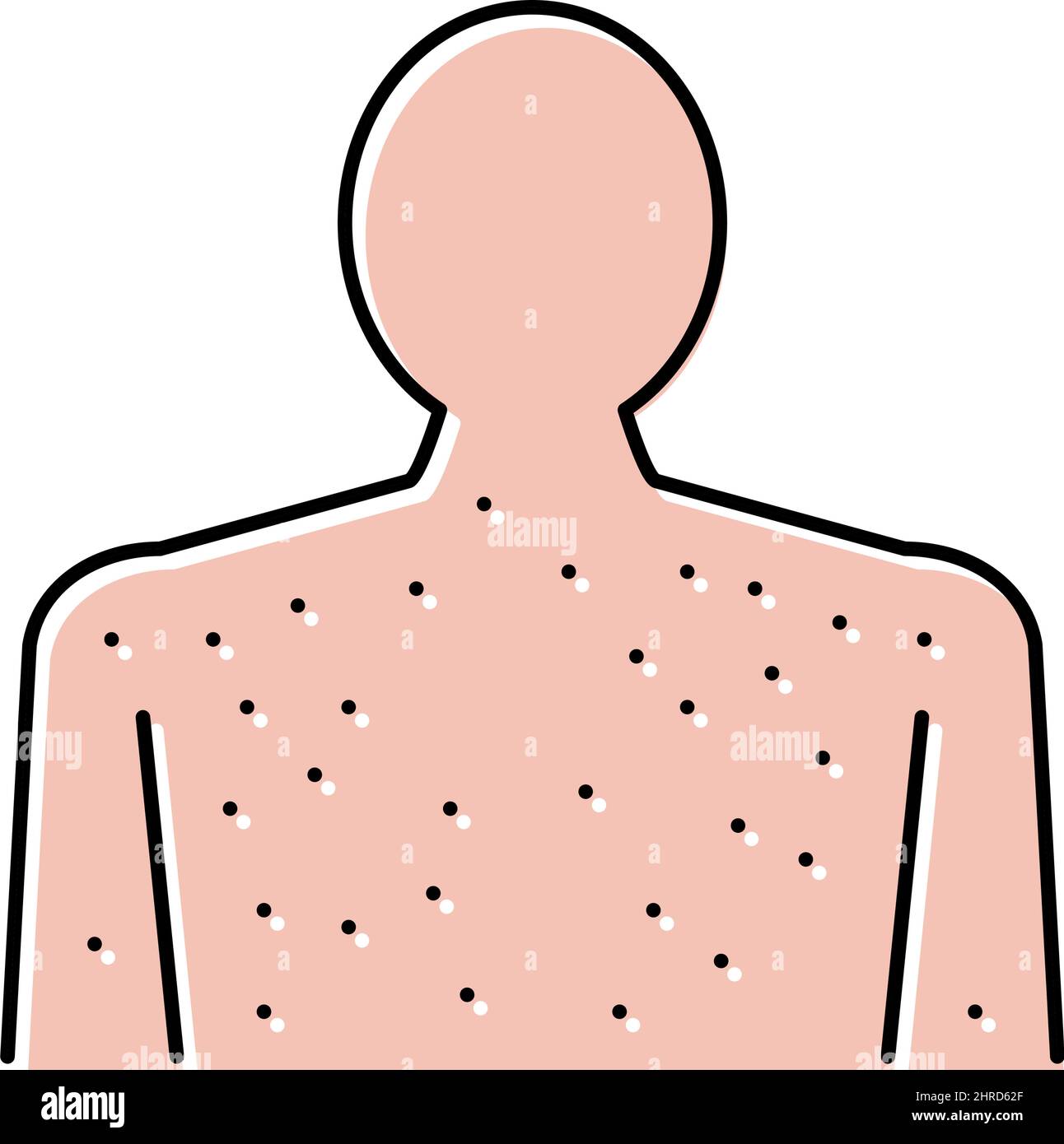 skin rash disease color icon vector illustration Stock Vector Image ...