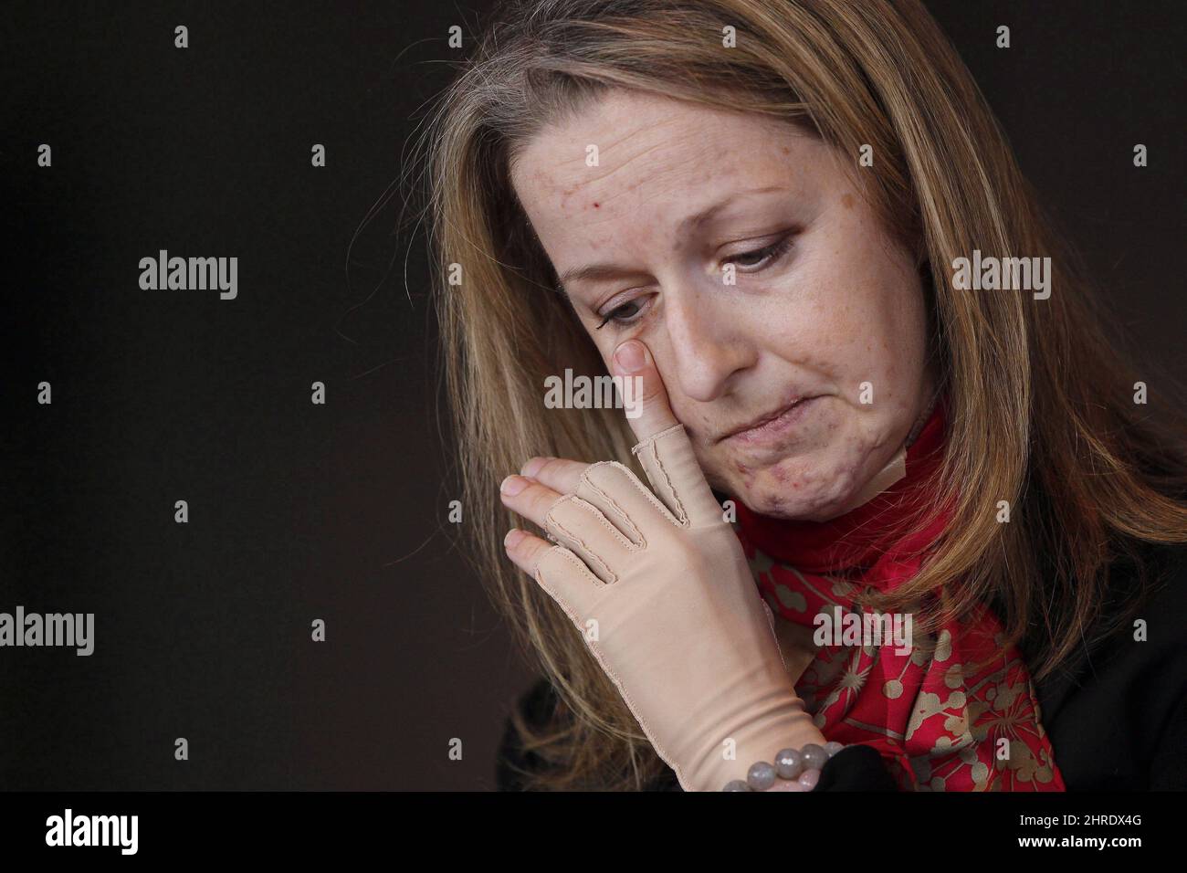 Lawyer Maria Mitousis, who was injured in an office bombing on July 3 ...