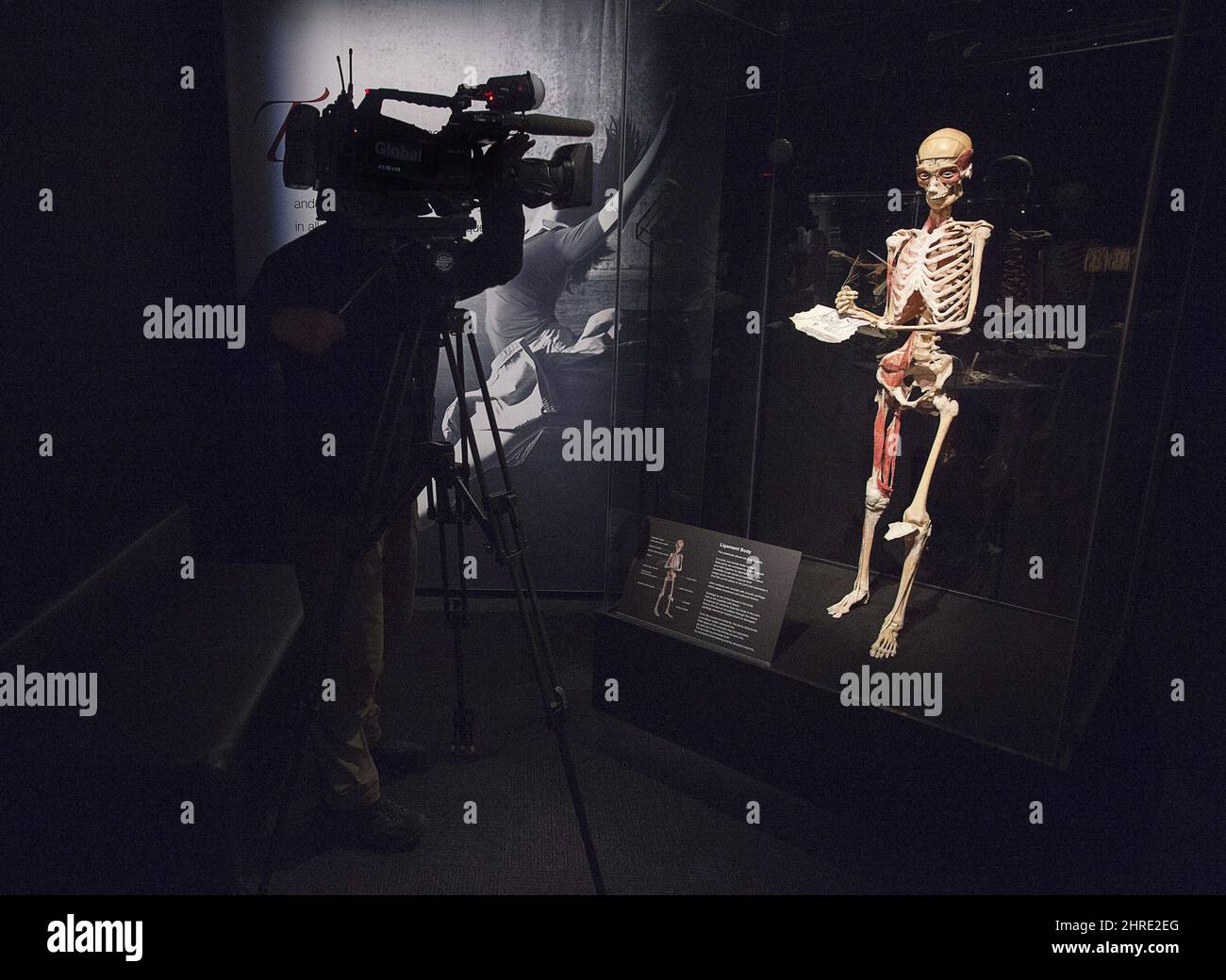 The Body Worlds RX exhibit is seen during a media tour at the Museum of ...