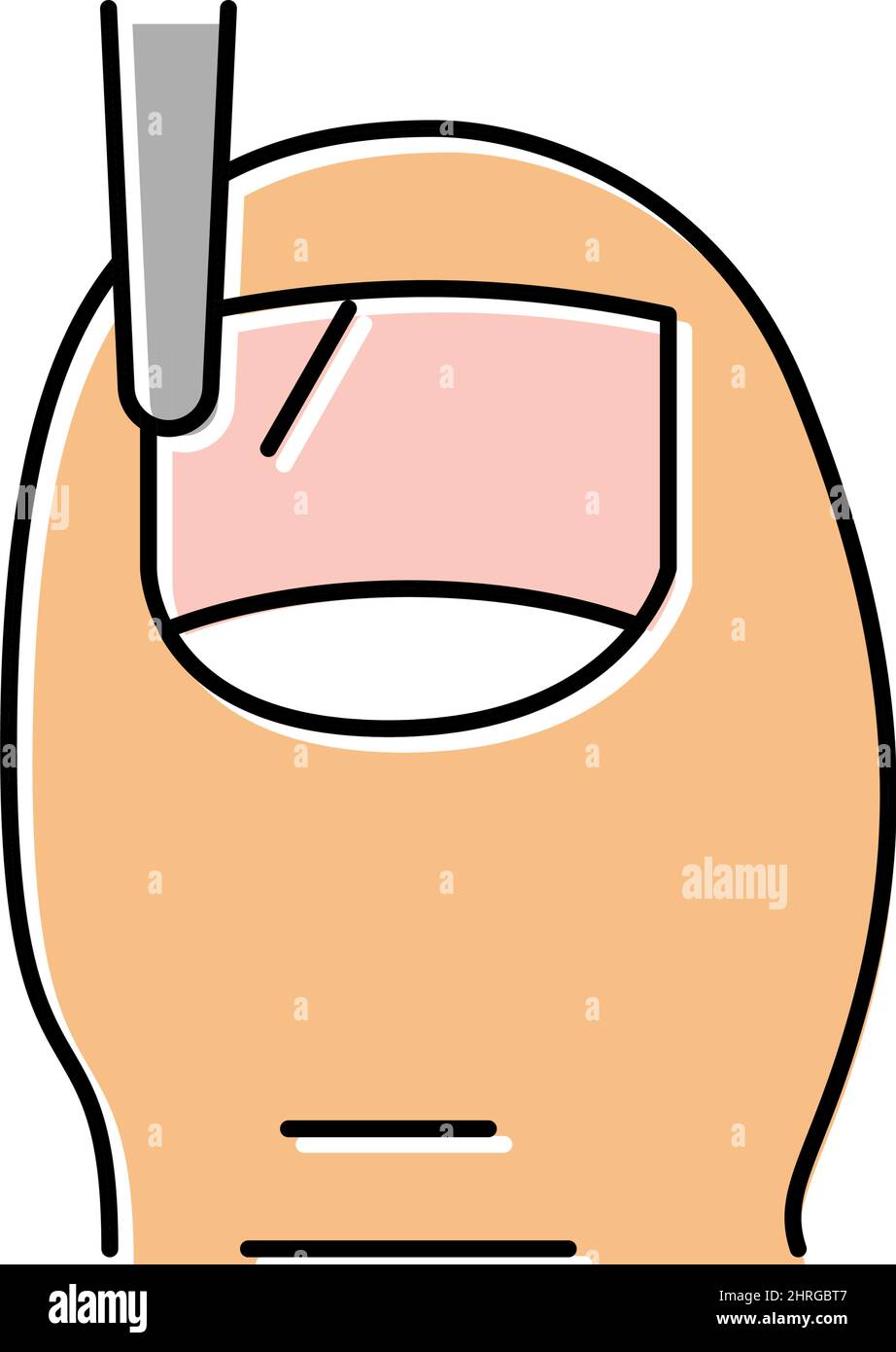 surgical intervention medical therapy color icon vector illustration ...